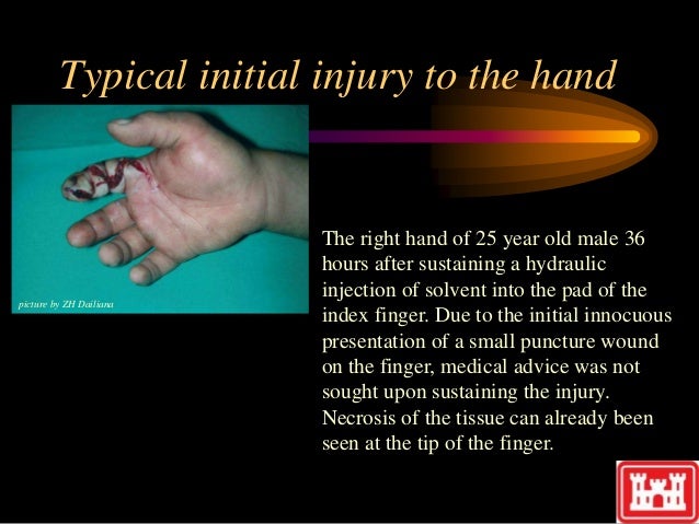 Fluid Injectioninjurytraining