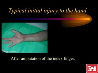 Injectioninjurytraining | PPSX