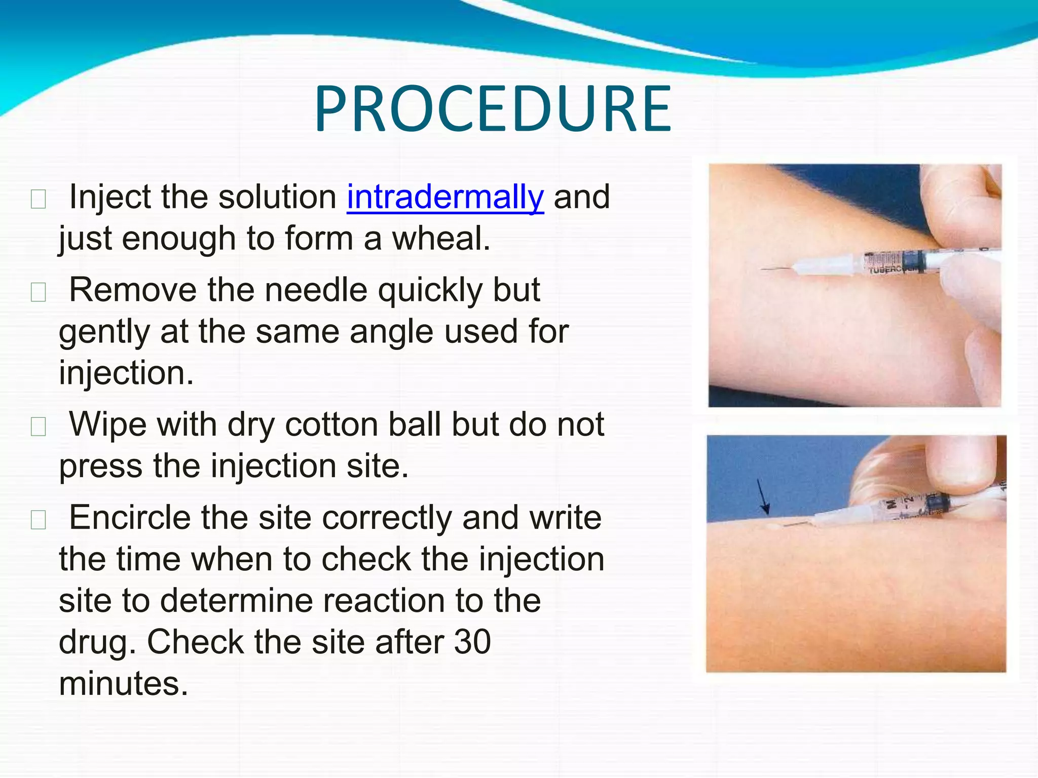 Injections | PPTX