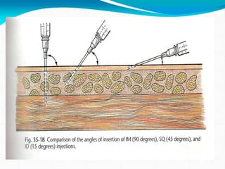 90 Degree Angle Injection