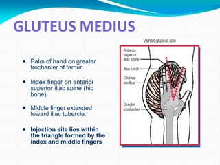 Injections | PPT