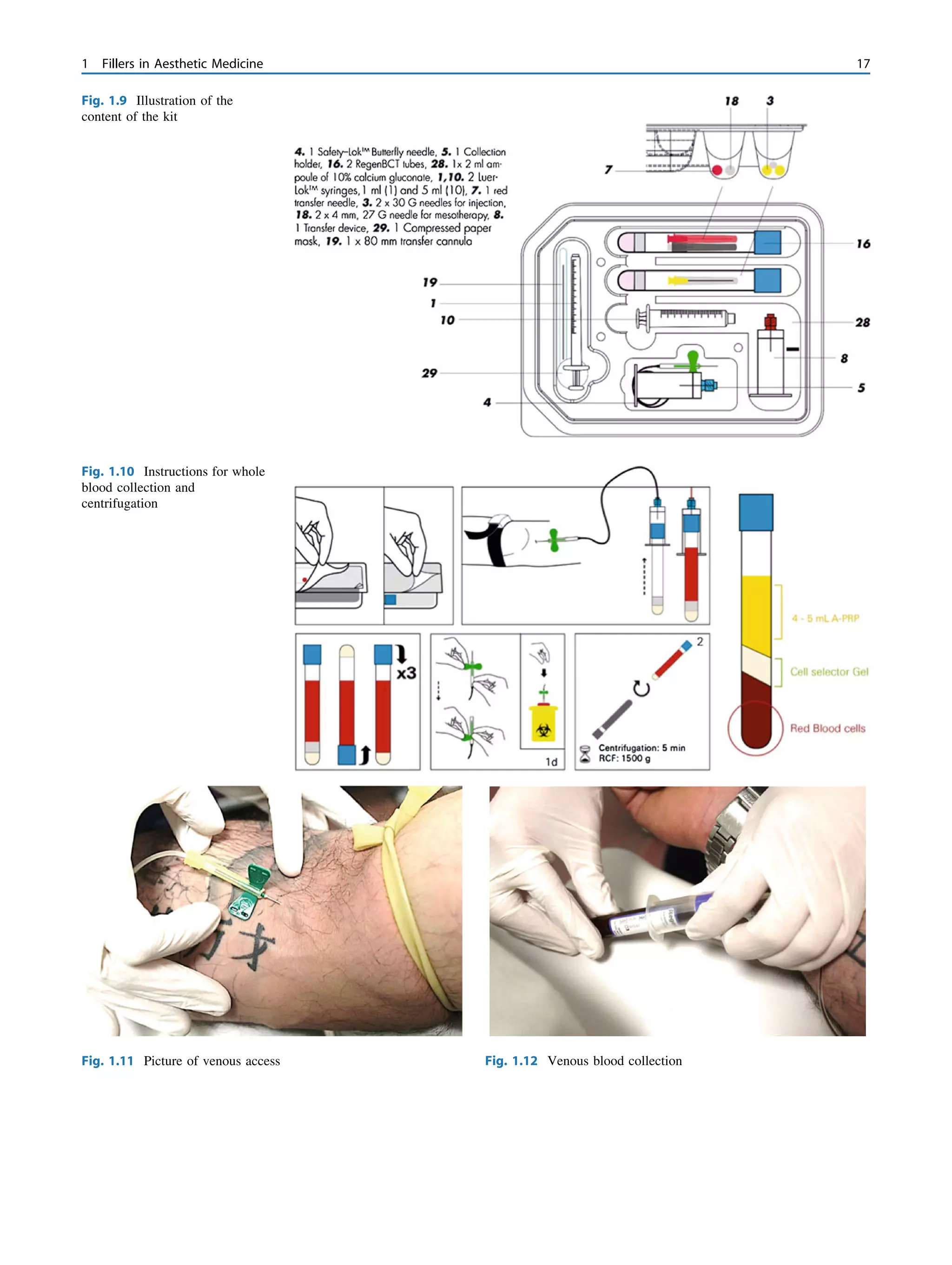 Injections in Aesthetic Medicine_ Atlas of Full-face and Full-body ...