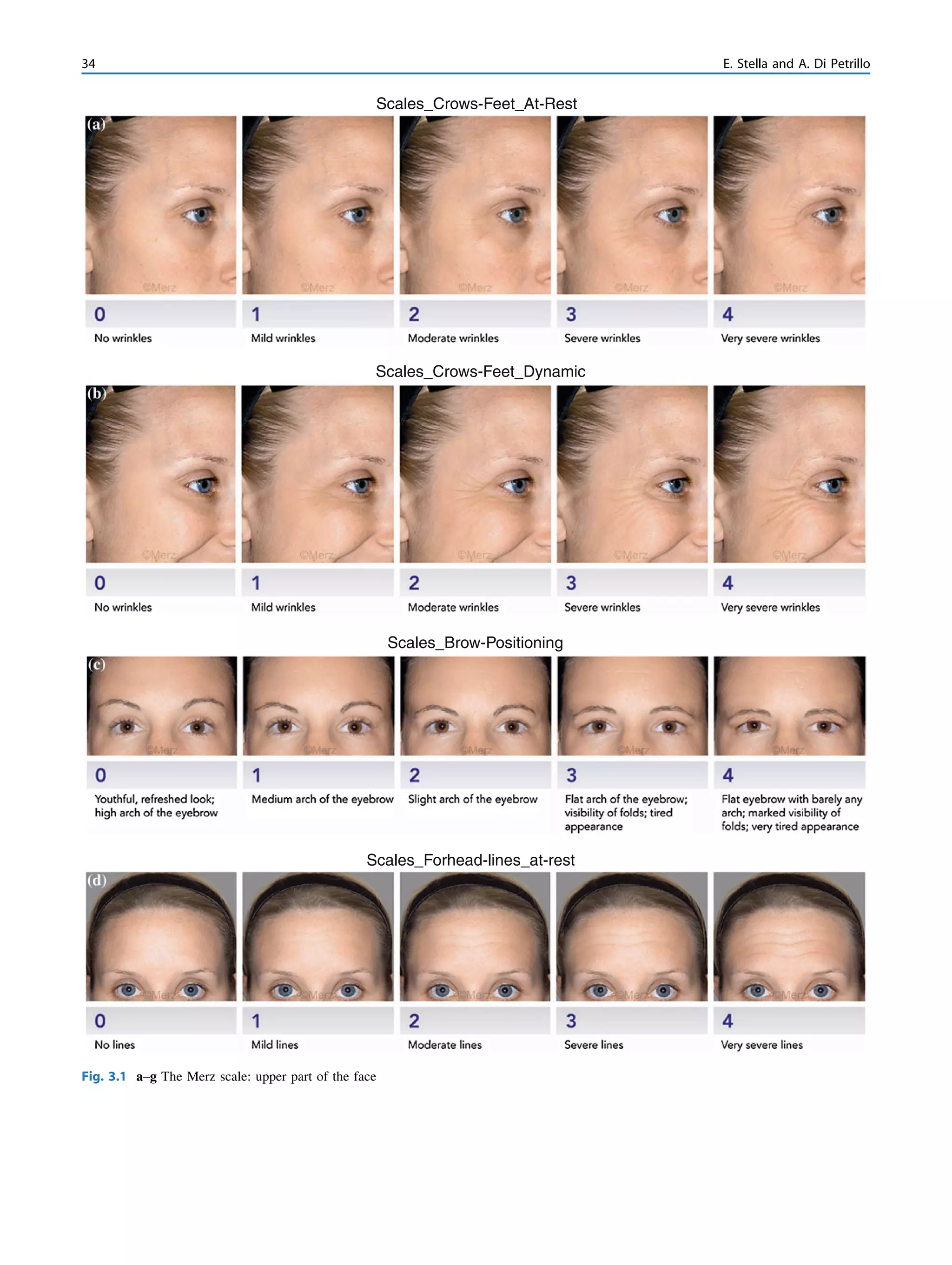 Injections in Aesthetic Medicine_ Atlas of Full-face and Full-body ...
