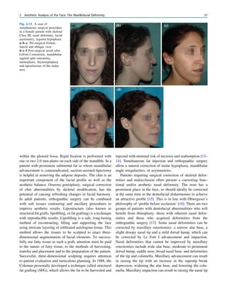 Injections in Aesthetic Medicine_ Atlas of Full-face and Full-body ...