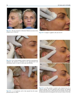 Injections in Aesthetic Medicine_ Atlas of Full-face and Full-body ...