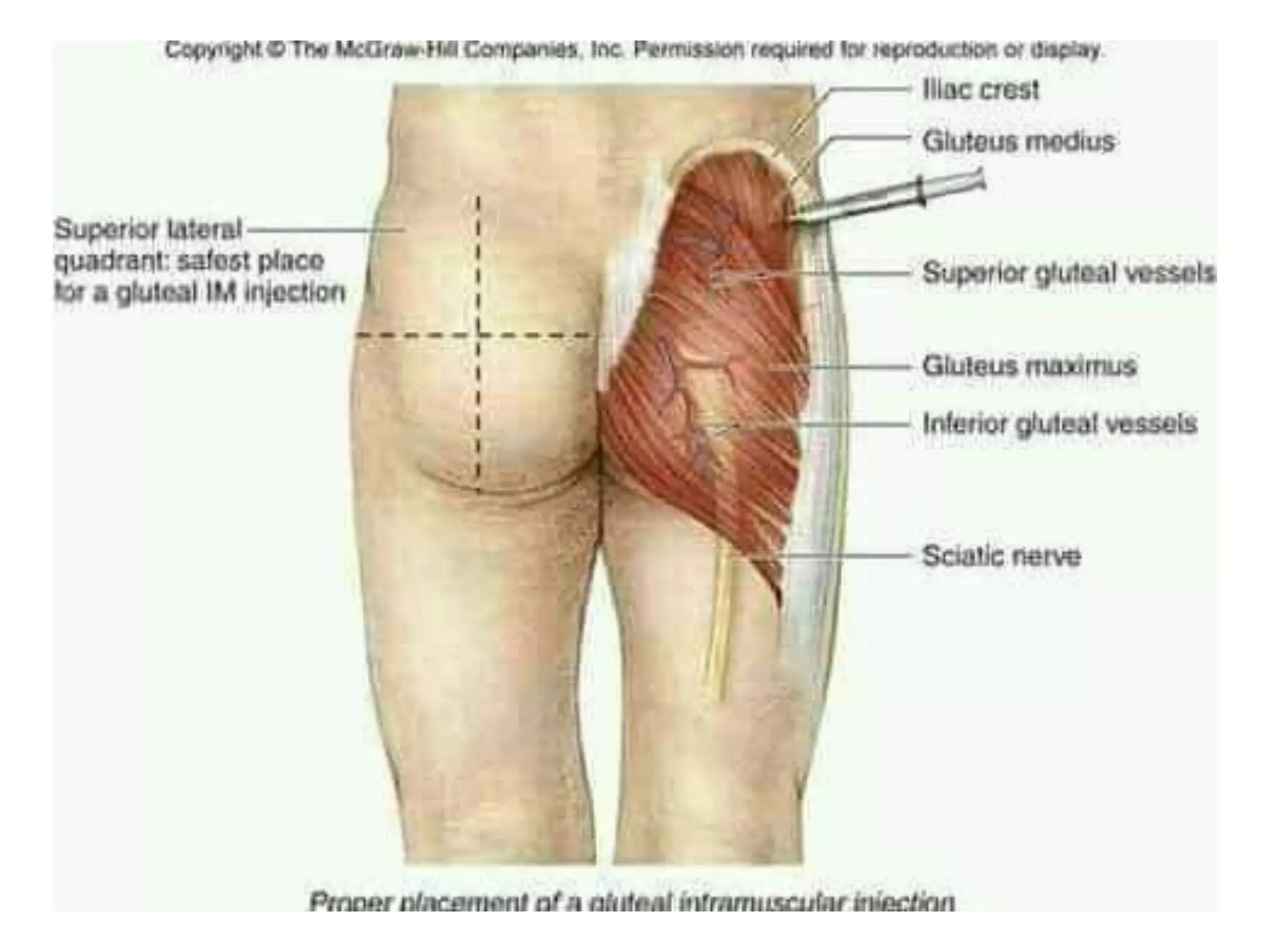 injectiontechnique.pptx