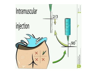 injectiontechnique.pptx