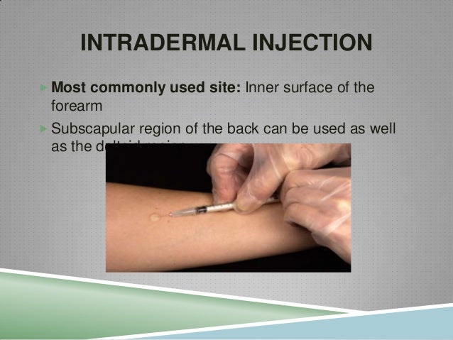 Intradermal Injection