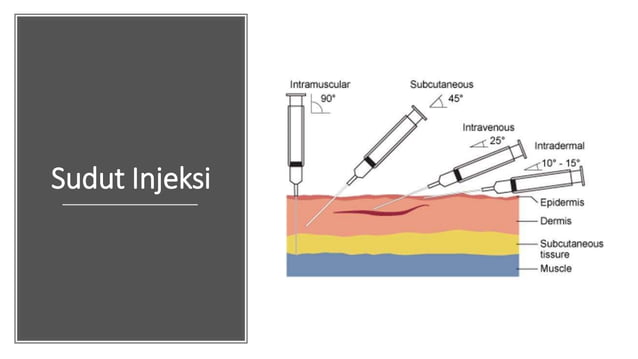 Injeksi Intravena (IV) - Master.pptx