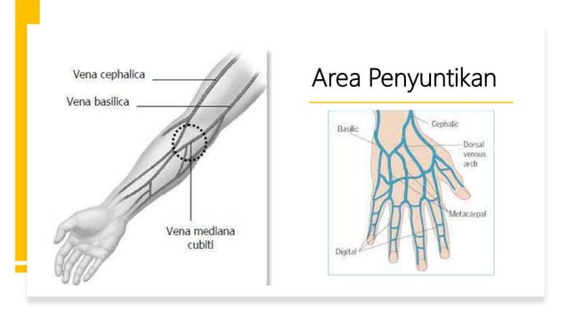 Injeksi Intravena (IV) - Master.pptx
