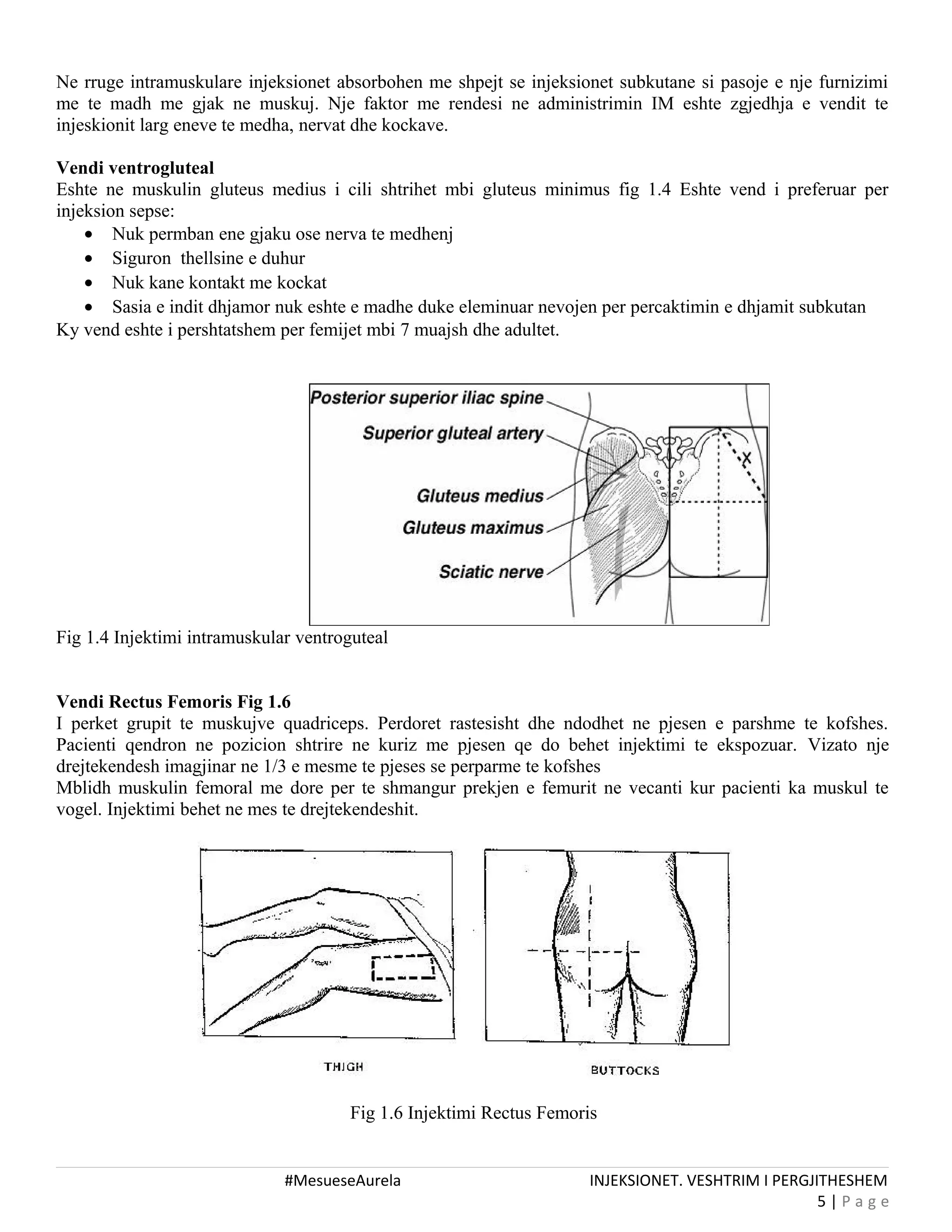 INJEKSIONET. VESHTRIM I PERGJITHESHEM | DOC