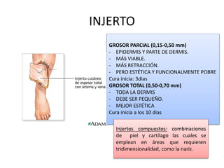 Injerto de piel | PPTX