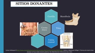 Injerto Oseo Alveolar | PPTX