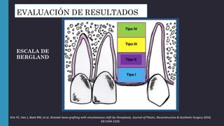 Injerto Oseo Alveolar | PPTX