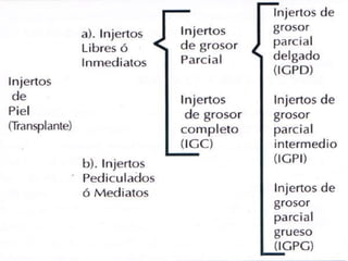 Injertos | PPTX