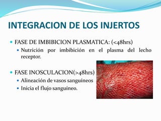 INJERTOS.pptx