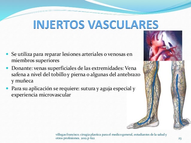 Injertos y-colgajos-cirugia-plastica