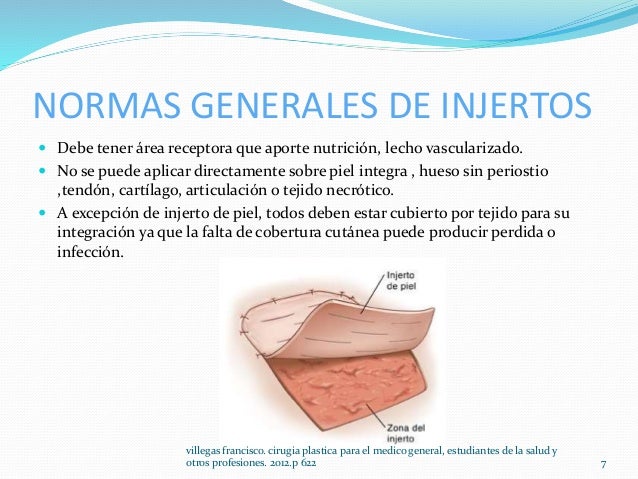 Injertos y-colgajos-cirugia-plastica