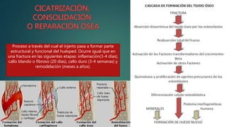 Injertos de hueso | PPTX