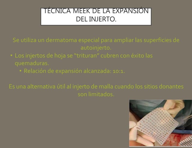Injertos de piel | PPTX