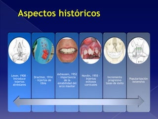 Injertos óseos alveolares | PPTX