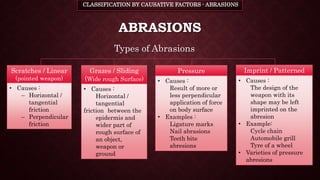 Injuries | PPTX