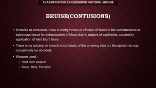 Injuries IN FORENSIC MEDICINE FOR CLASS PRESENTATION | PPTX