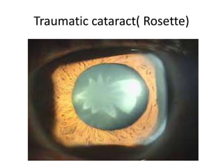 Injuries2 08.09.16, dr.k.srikanth | PPTX | Death, Injury, or Military ...