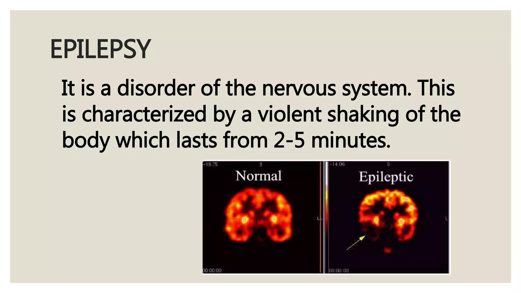 Injuries and diseases that affect the nervous system (lesson 9) | PPTX