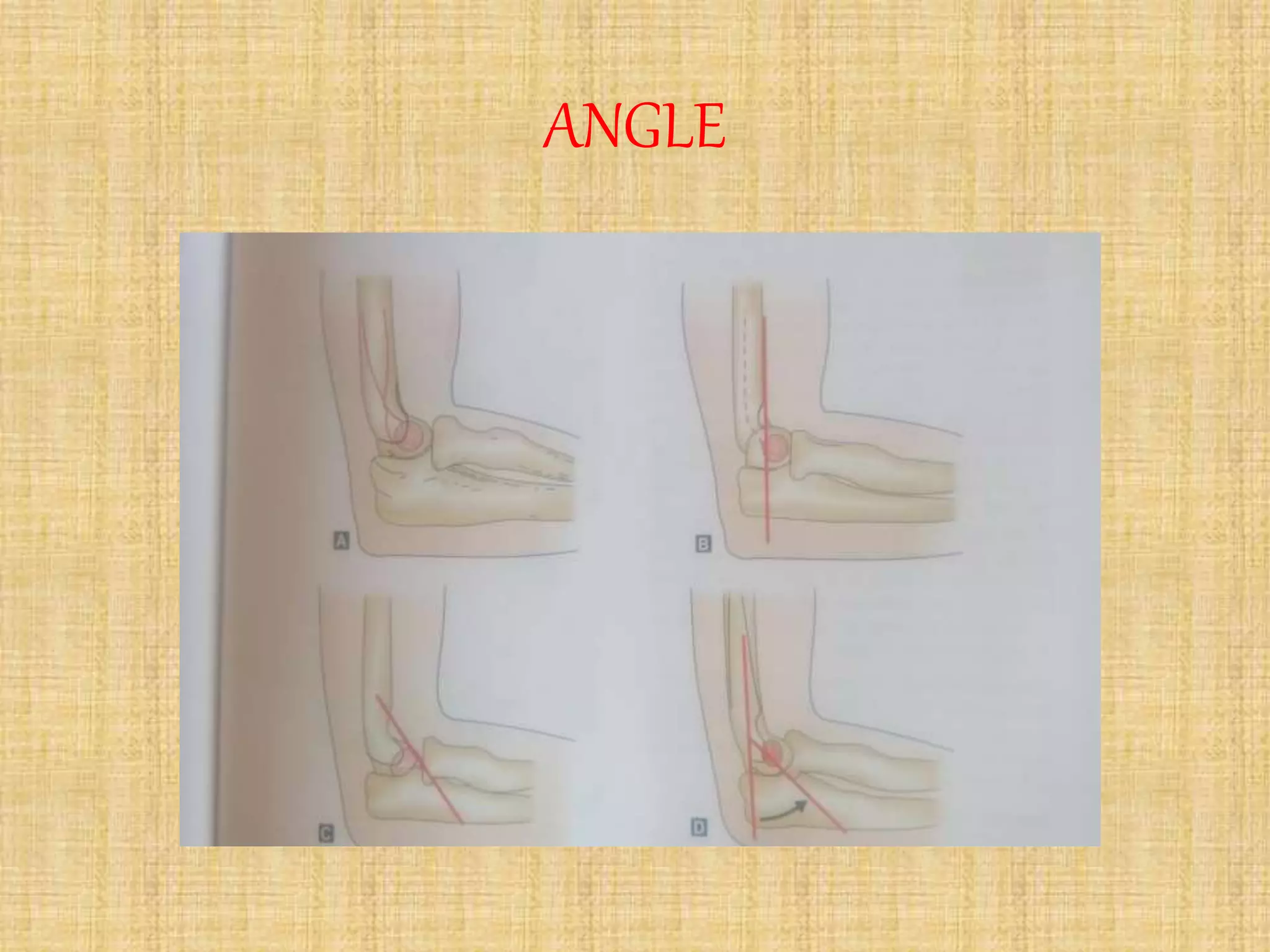 Injuries around elbow in children | PPTX