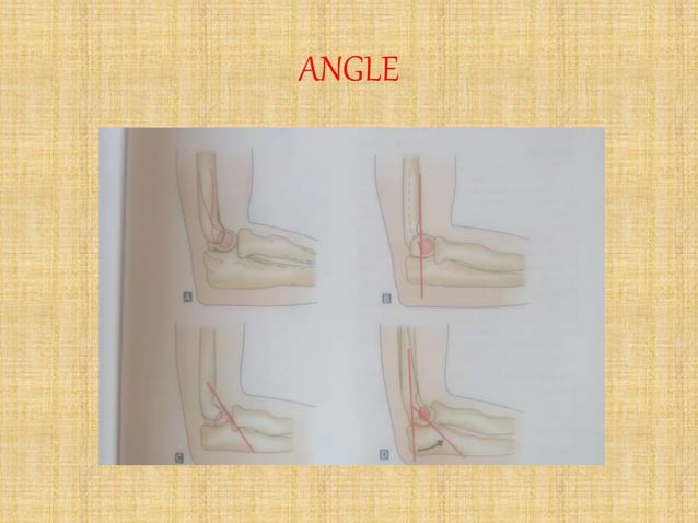 Injuries around elbow in children | PPT
