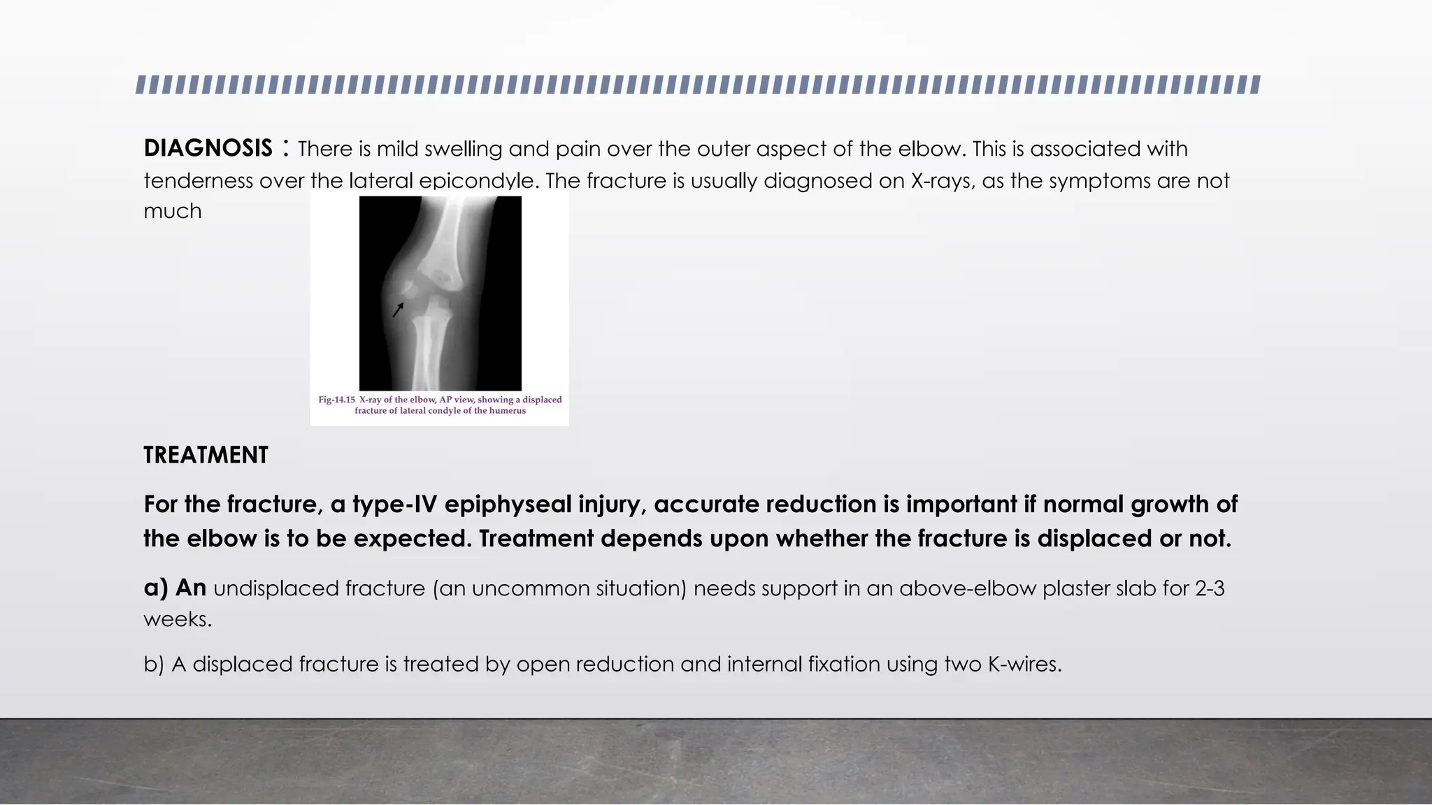 Injuries around Elbow Joint power point.pptx