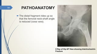 Injuries around hip joint | PPTX