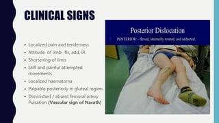 Injuries around hip joint | PPTX