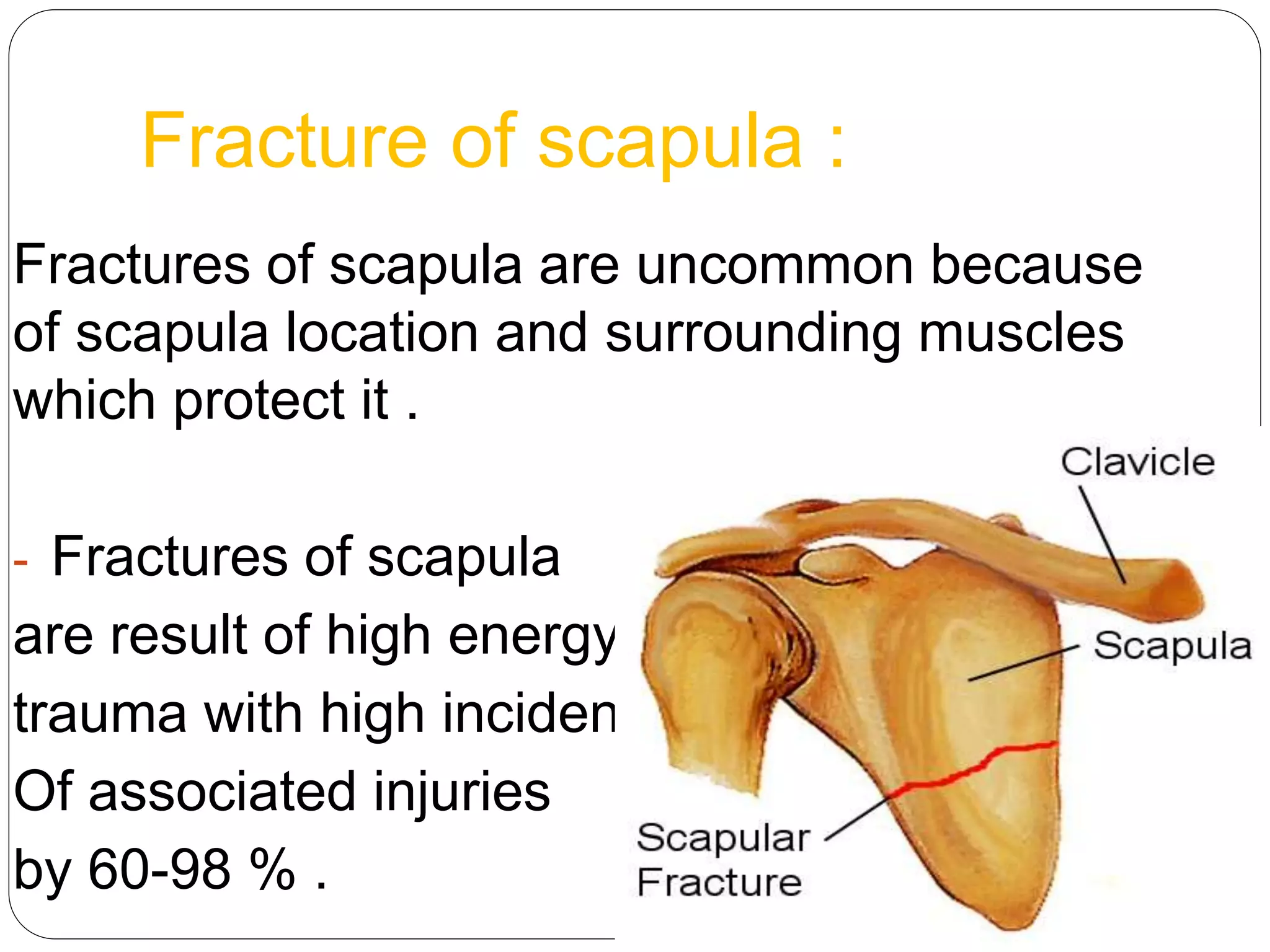 shoulder dislocation,scapula ,clavicle and all injuries around shoulder ...