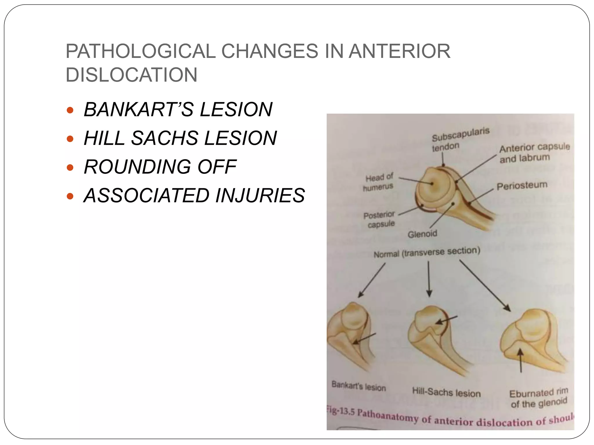 shoulder dislocation,scapula ,clavicle and all injuries around shoulder ...