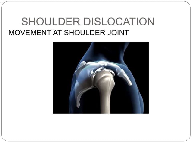 shoulder dislocation,scapula ,clavicle and all injuries around shoulder ...
