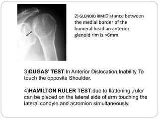 shoulder dislocation,scapula ,clavicle and all injuries around shoulder ...