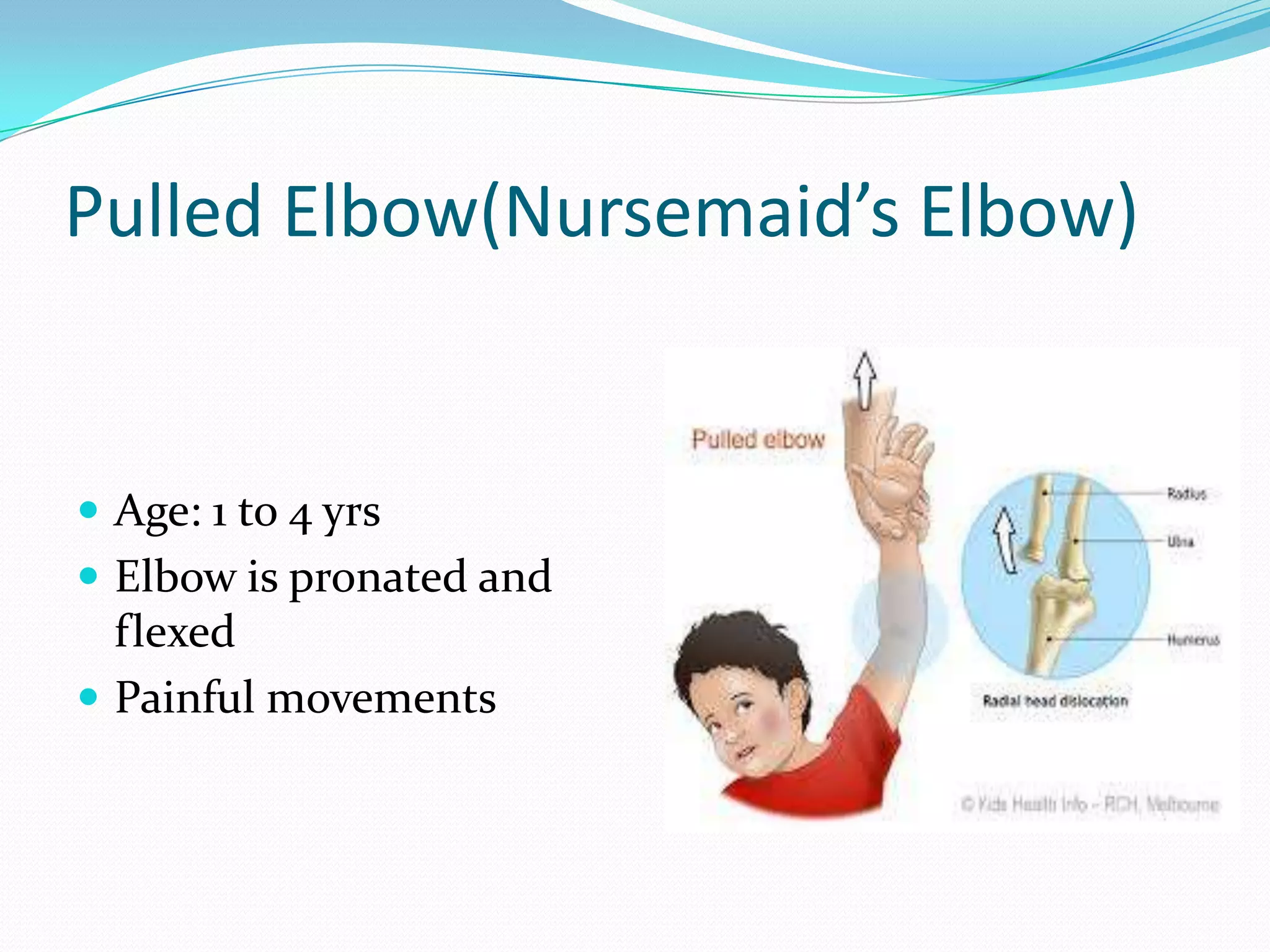 Injuries around the elbow | PPTX