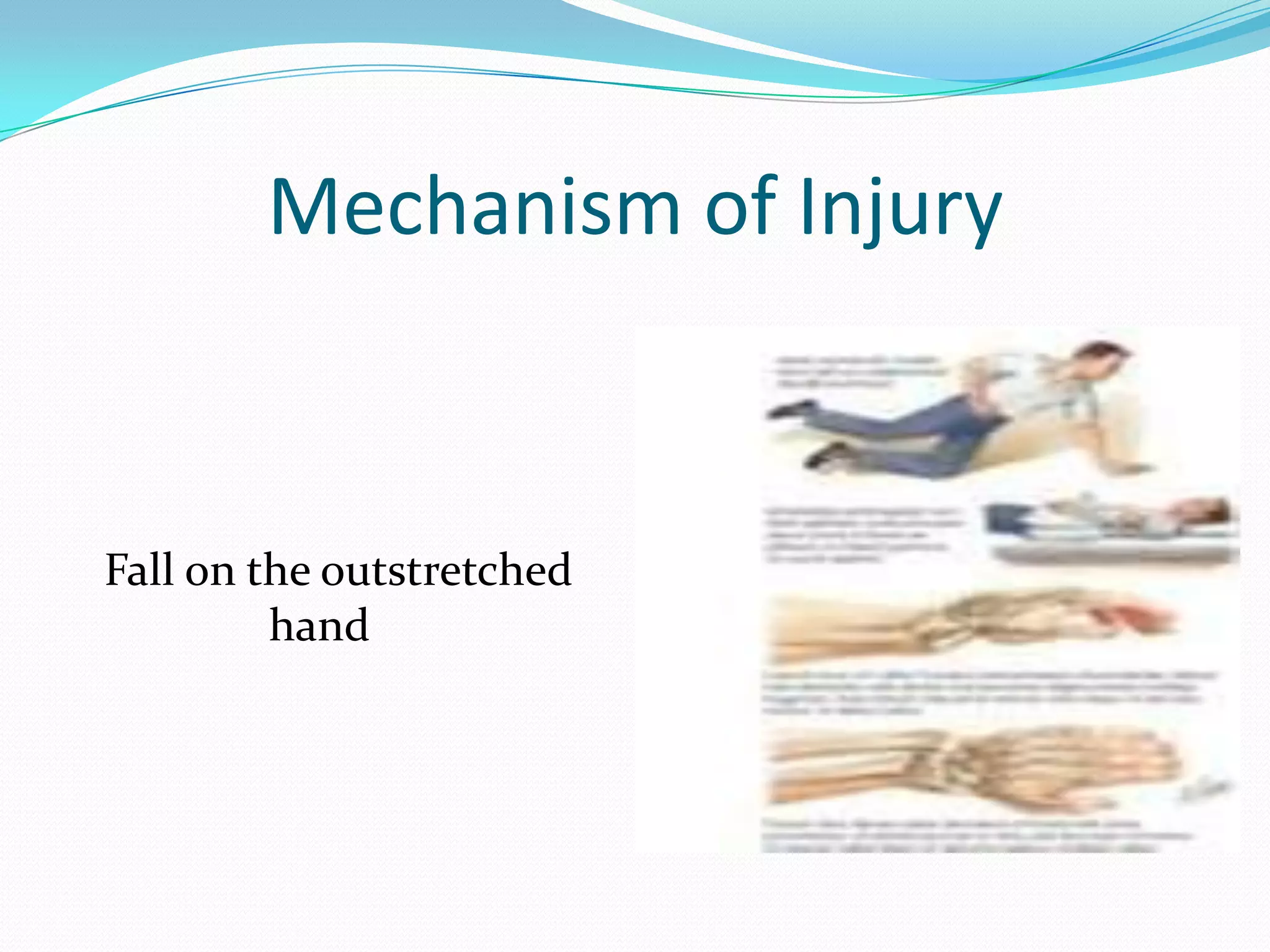 Injuries around the elbow | PPTX
