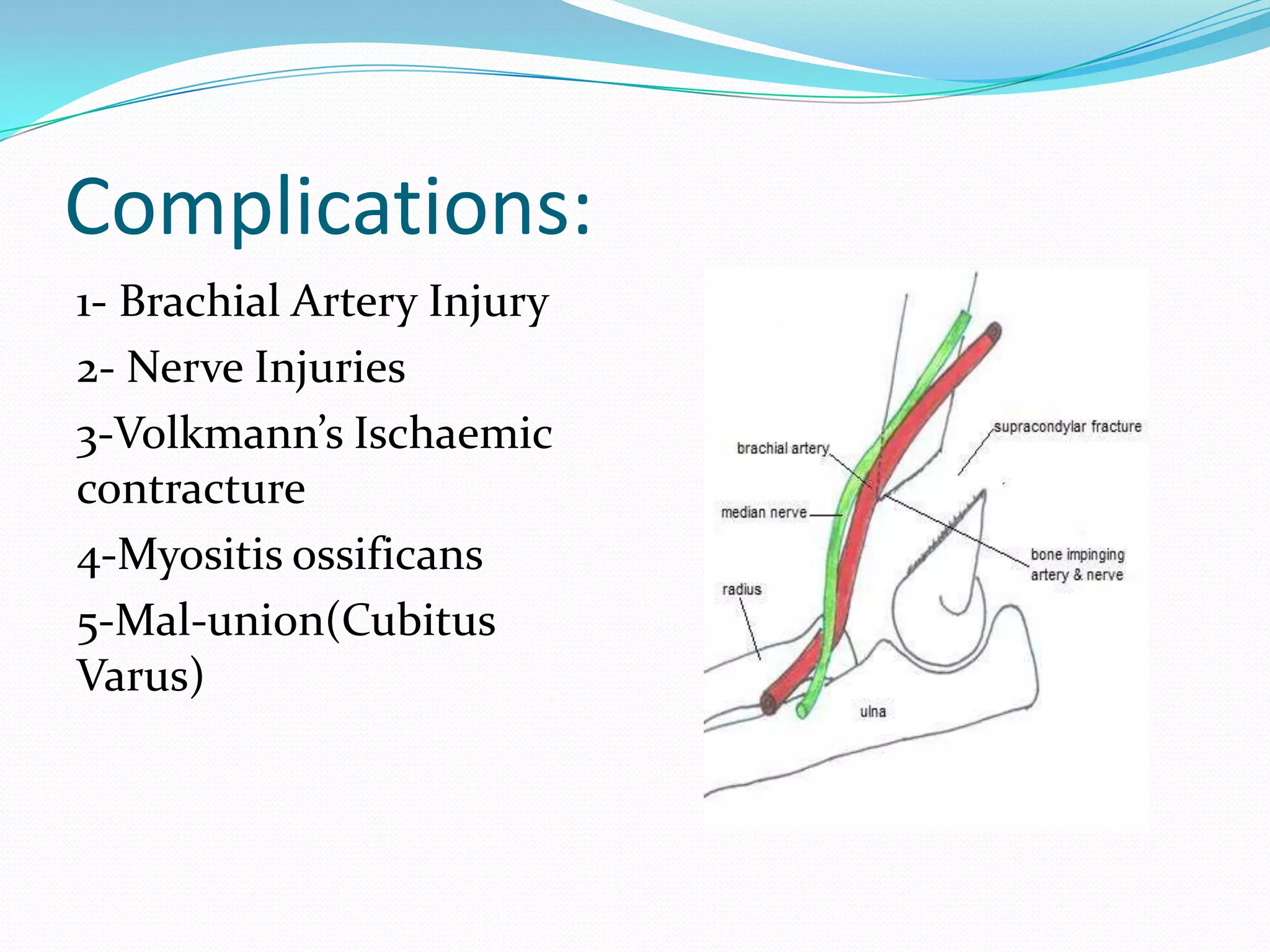Injuries Around The Elbow Ppt