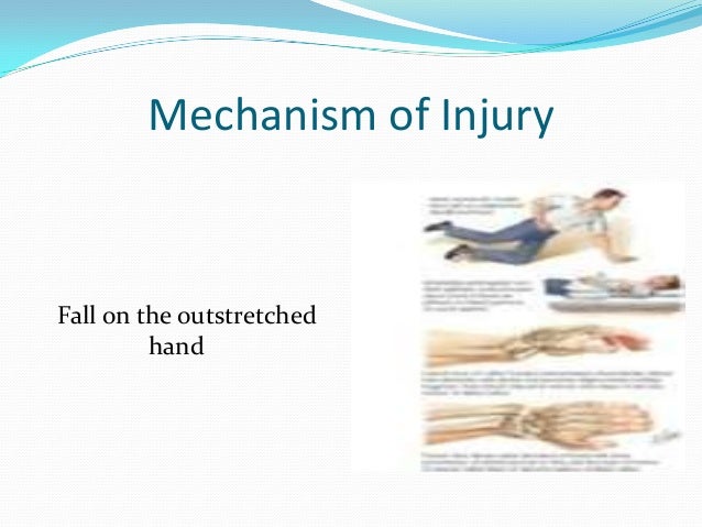 Injuries around the elbow