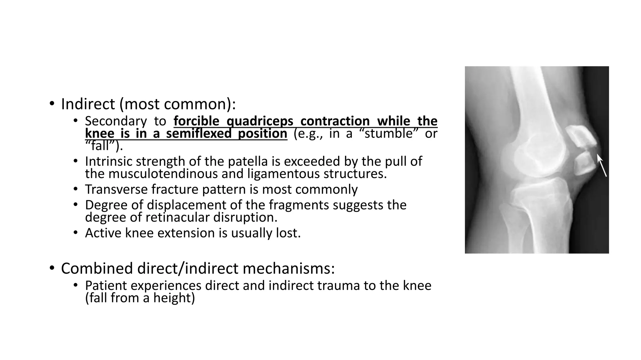 Injuries around the knee | PDF