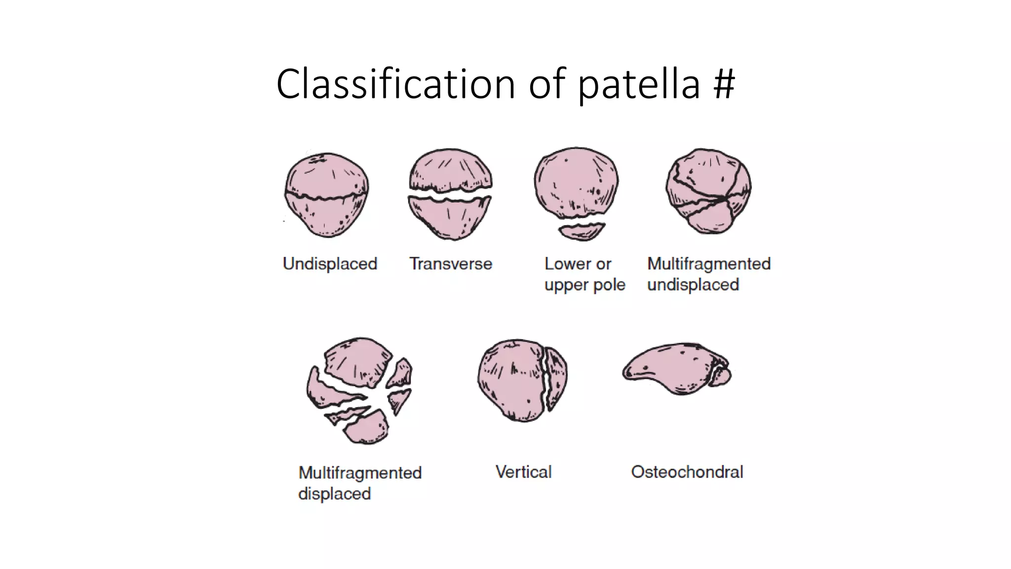 Injuries around the knee | PDF