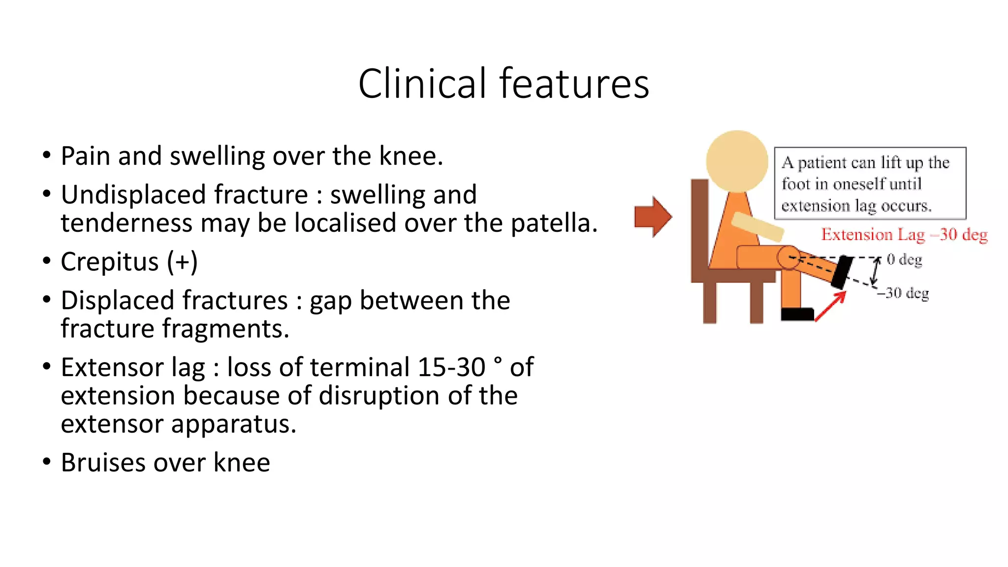 Injuries around the knee | PDF