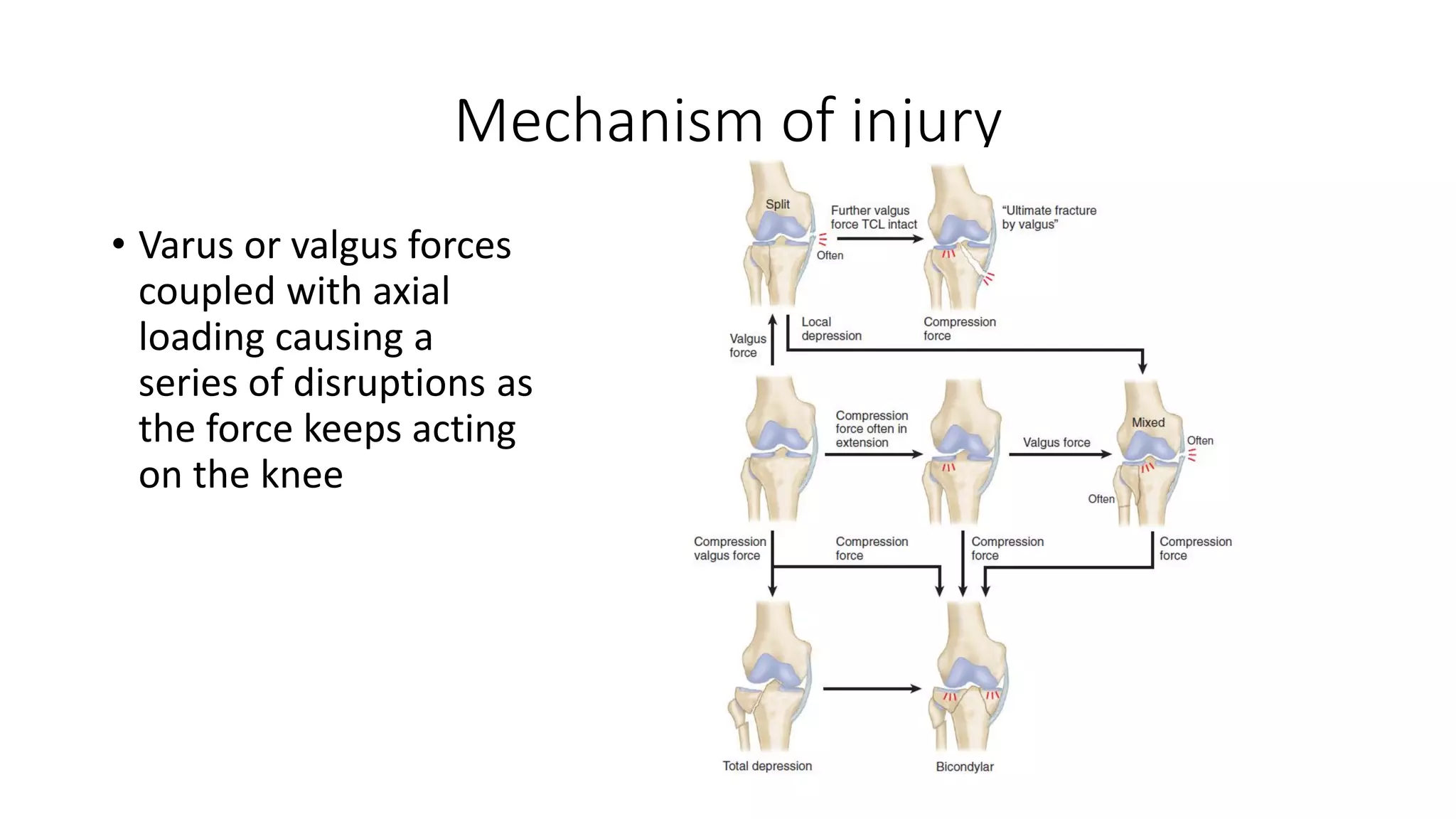 Injuries around the knee | PDF