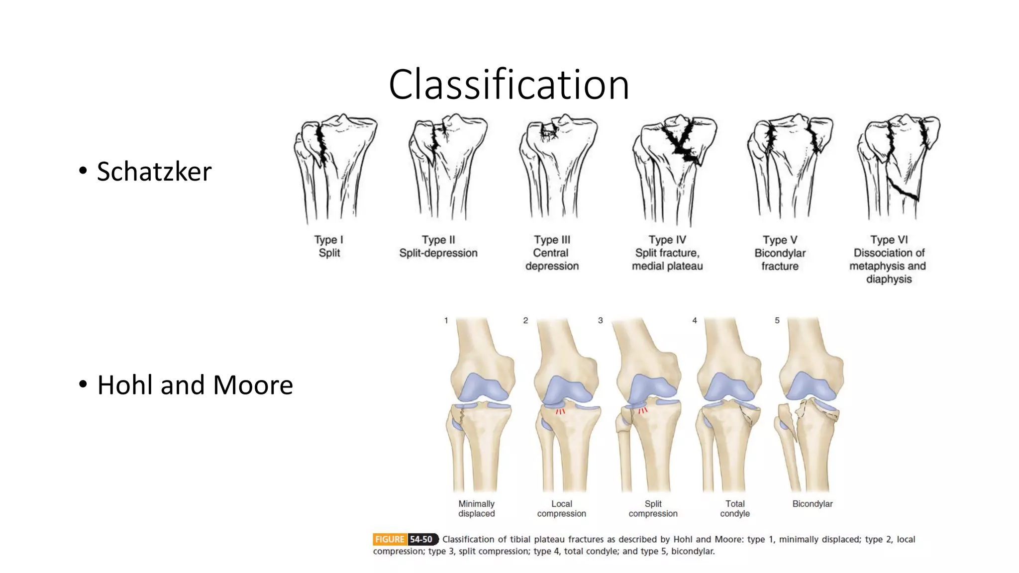Injuries around the knee | PDF