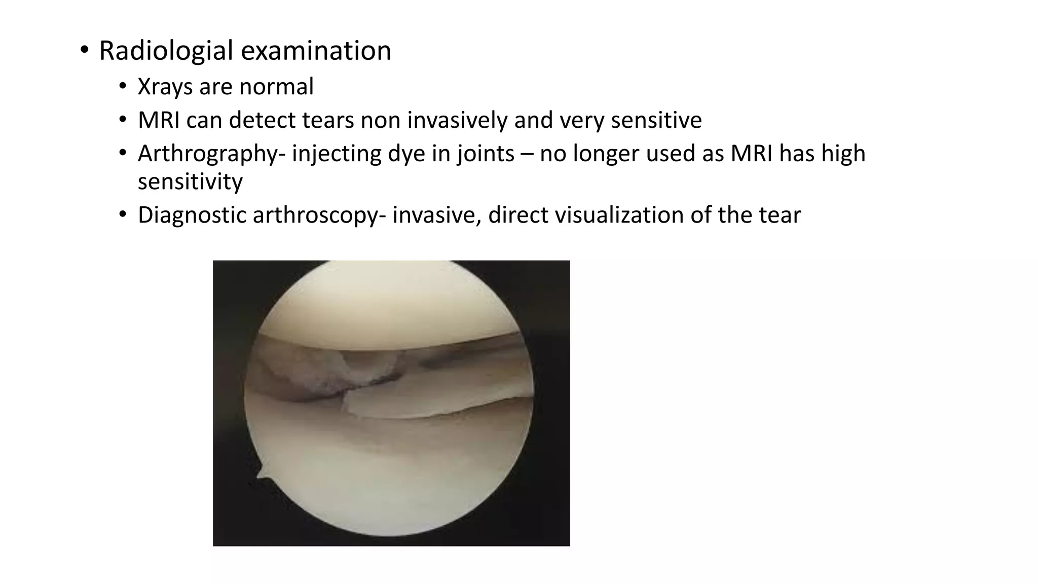 Injuries around the knee | PDF