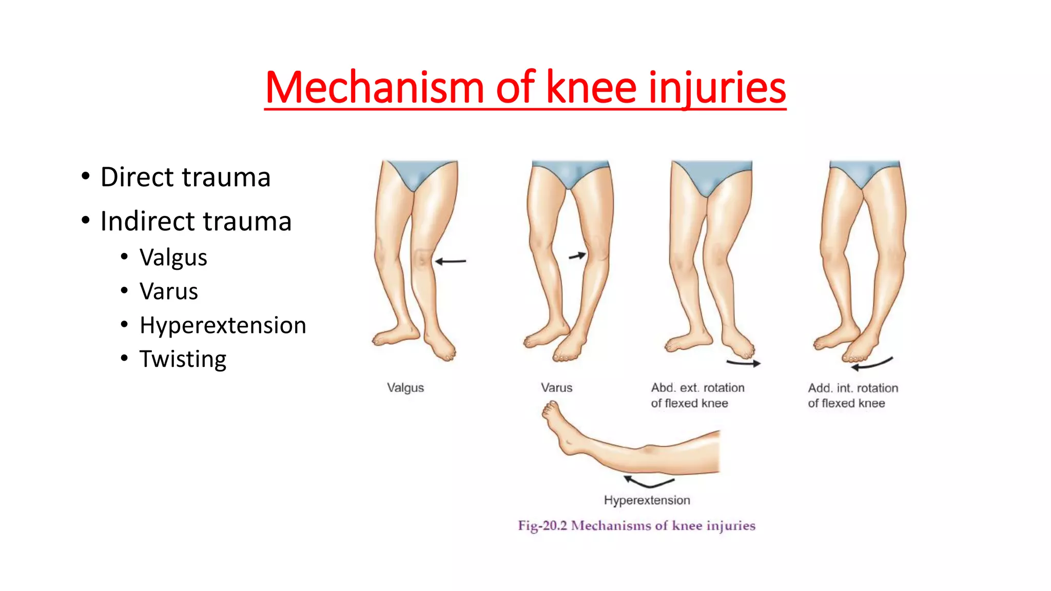 Injuries around the knee | PDF