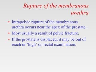 Injuries male urethra.pptx